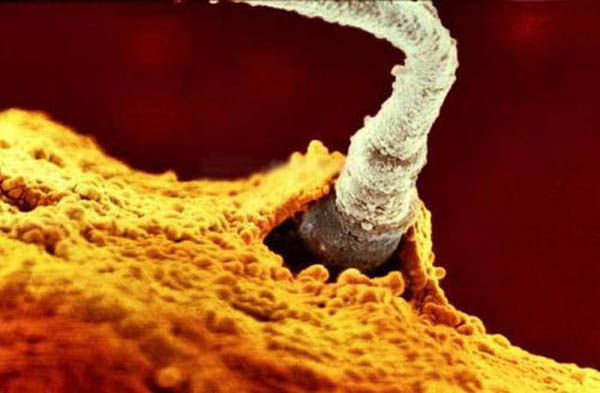 Servicio de noticias en salud Al Día – ¿Cómo se fusionan dos gametos?